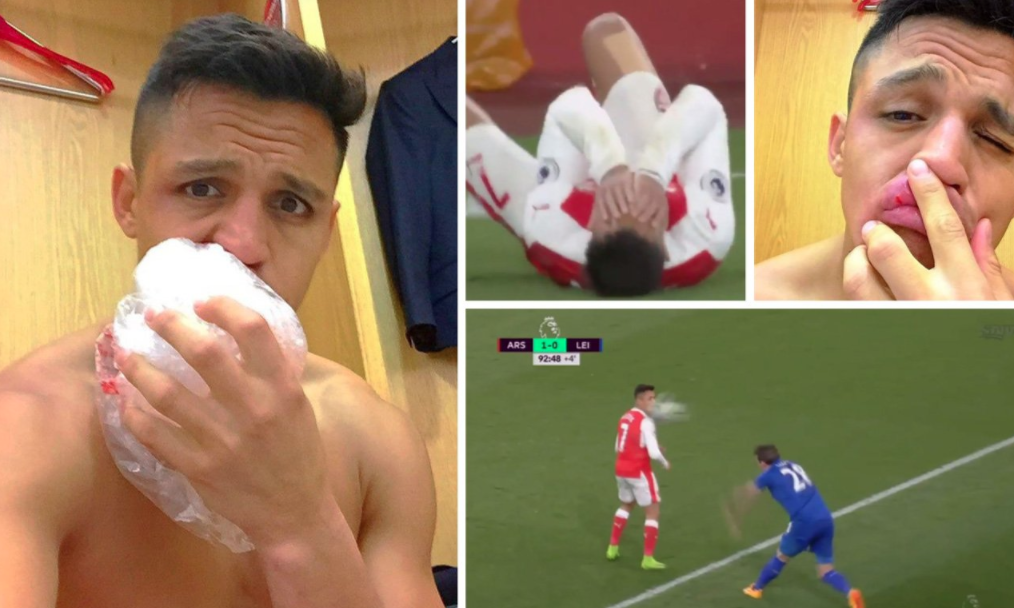 Alexis Sanchez Reminded Us Why We All Hate Flopping | The18